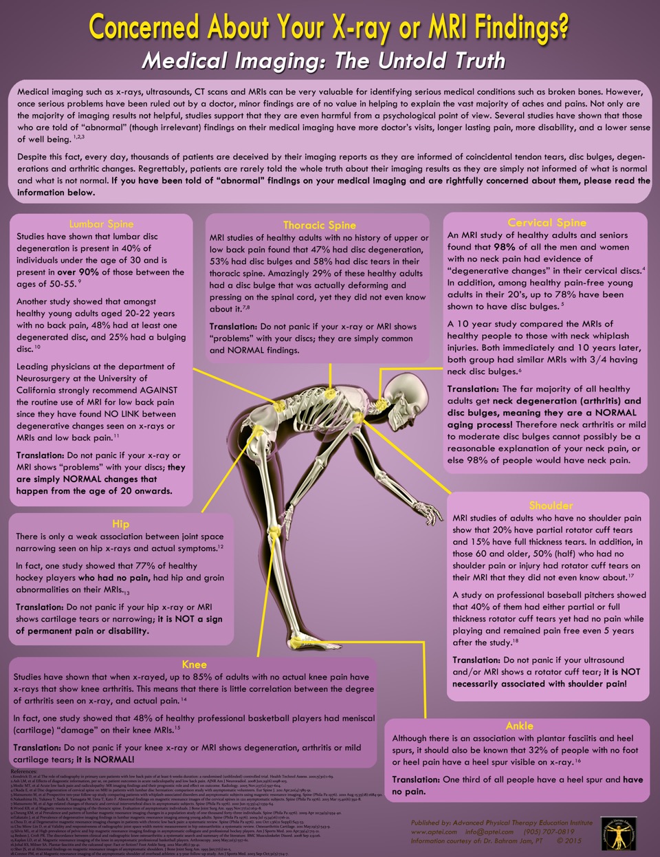 Concerned about your X-ray or MRI Findings? ~ Surge Physiotherapy