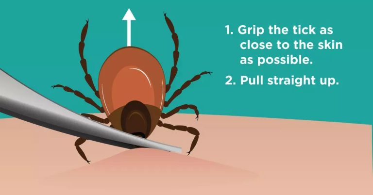 Insect bites, treatment and prevention | Sponsored by Pharmasave