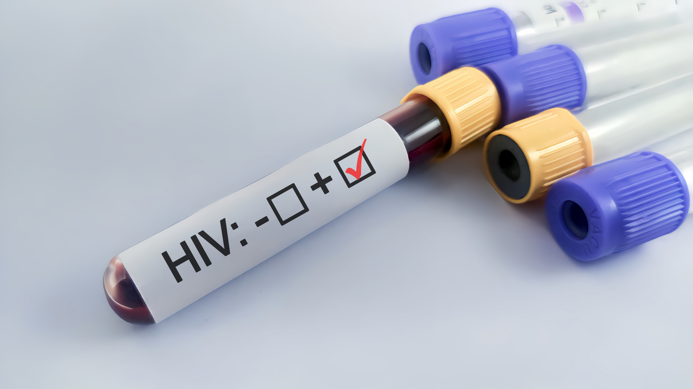 Ontario committee on HIV/AIDS reminds people that 11% of those living ...